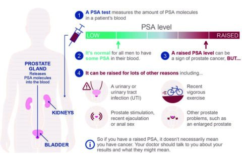 PSA Blood Test: Understanding Prostate Cancer Screening | The Pelvic ...
