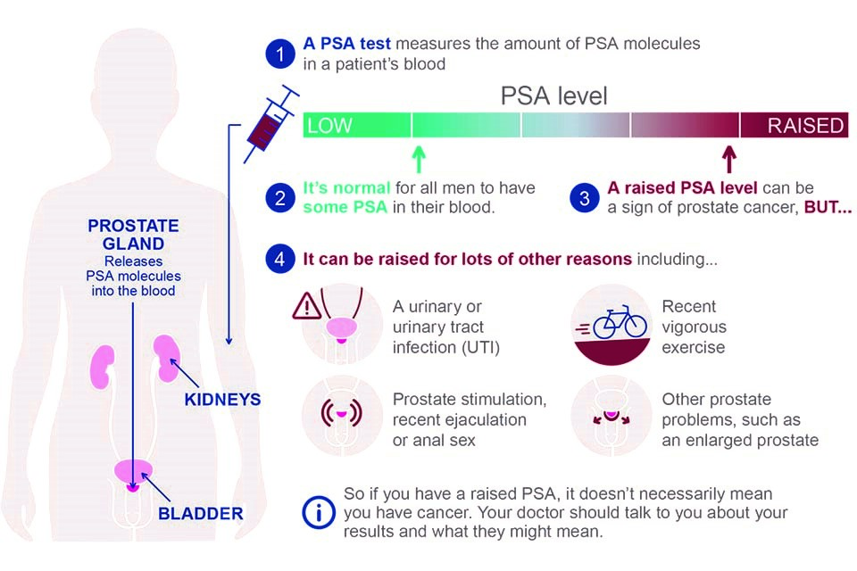 Psa Screening